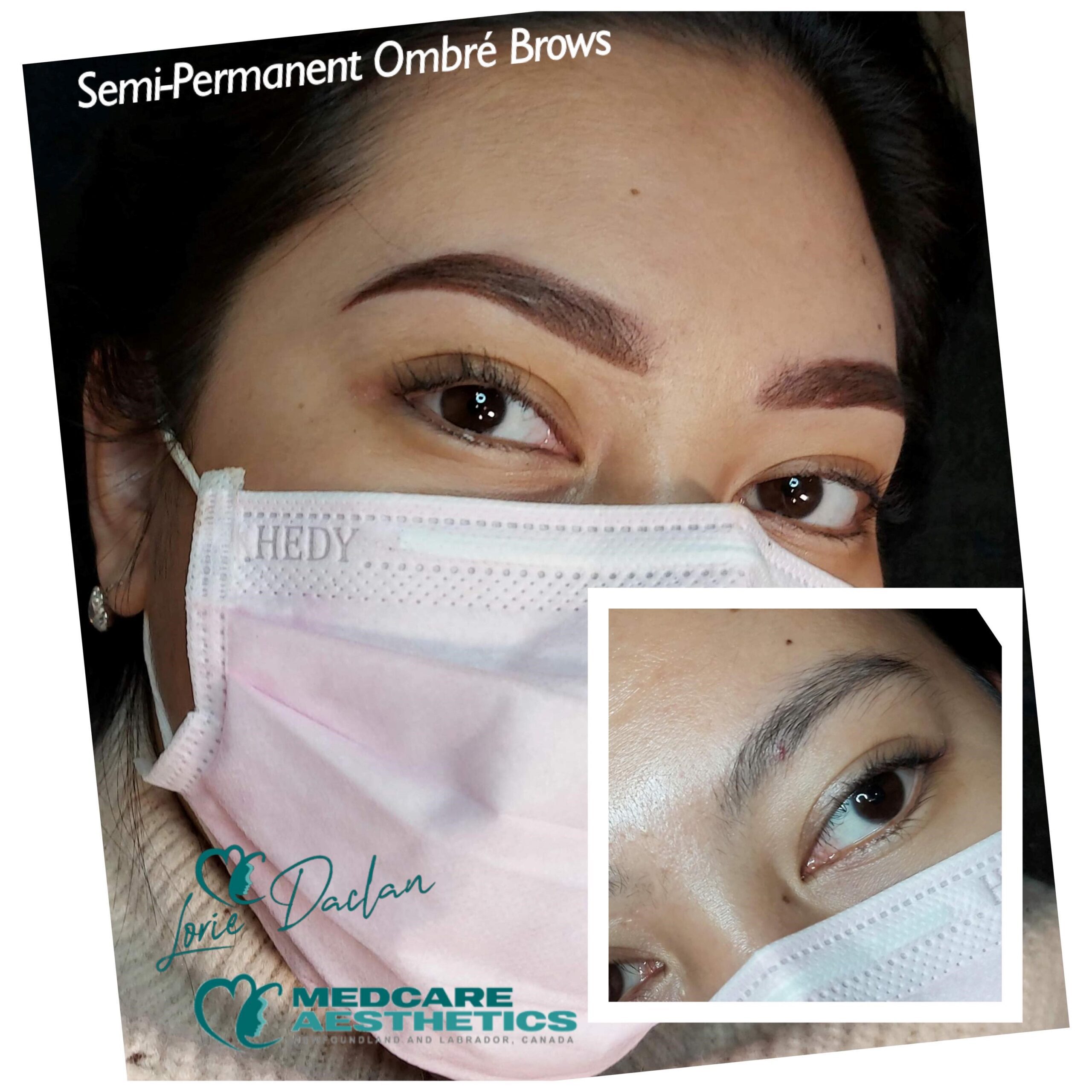 Semi Permanent Makeup - Medcare Aesthetics