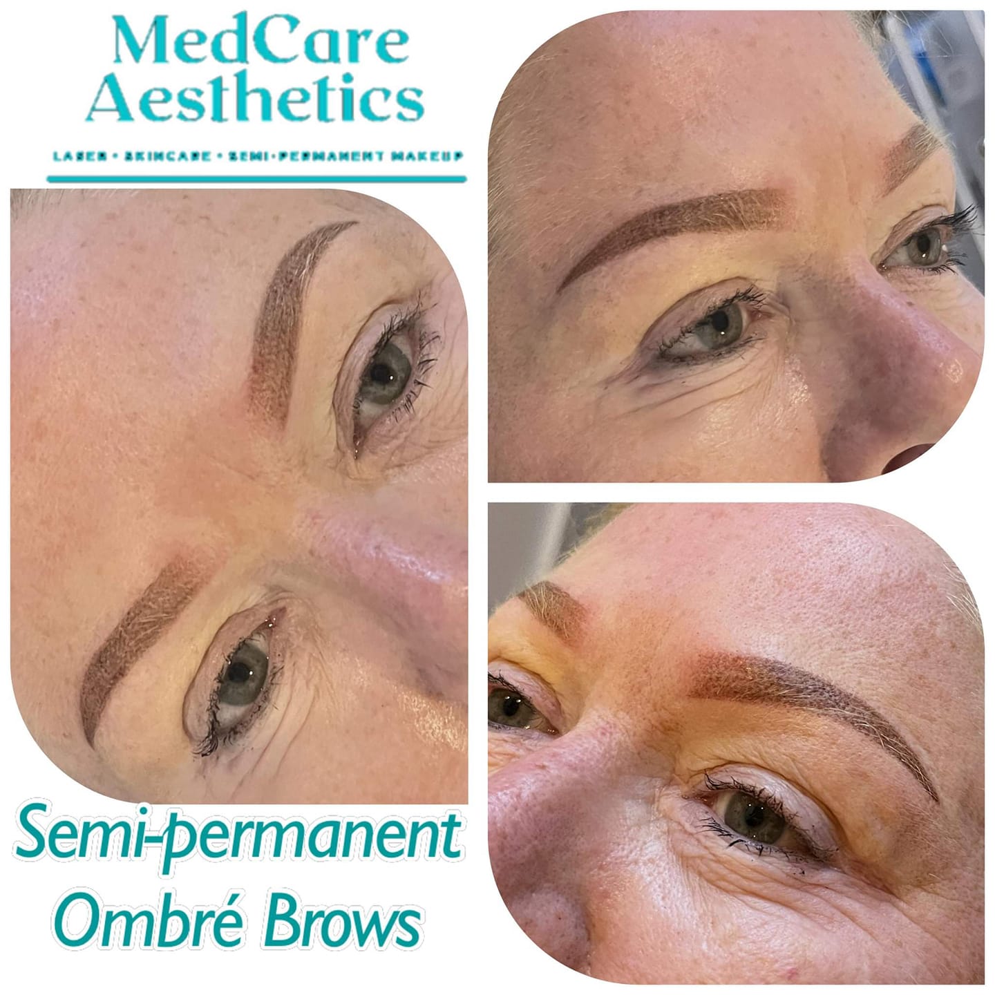 Semi Permanent Makeup - Medcare Aesthetics