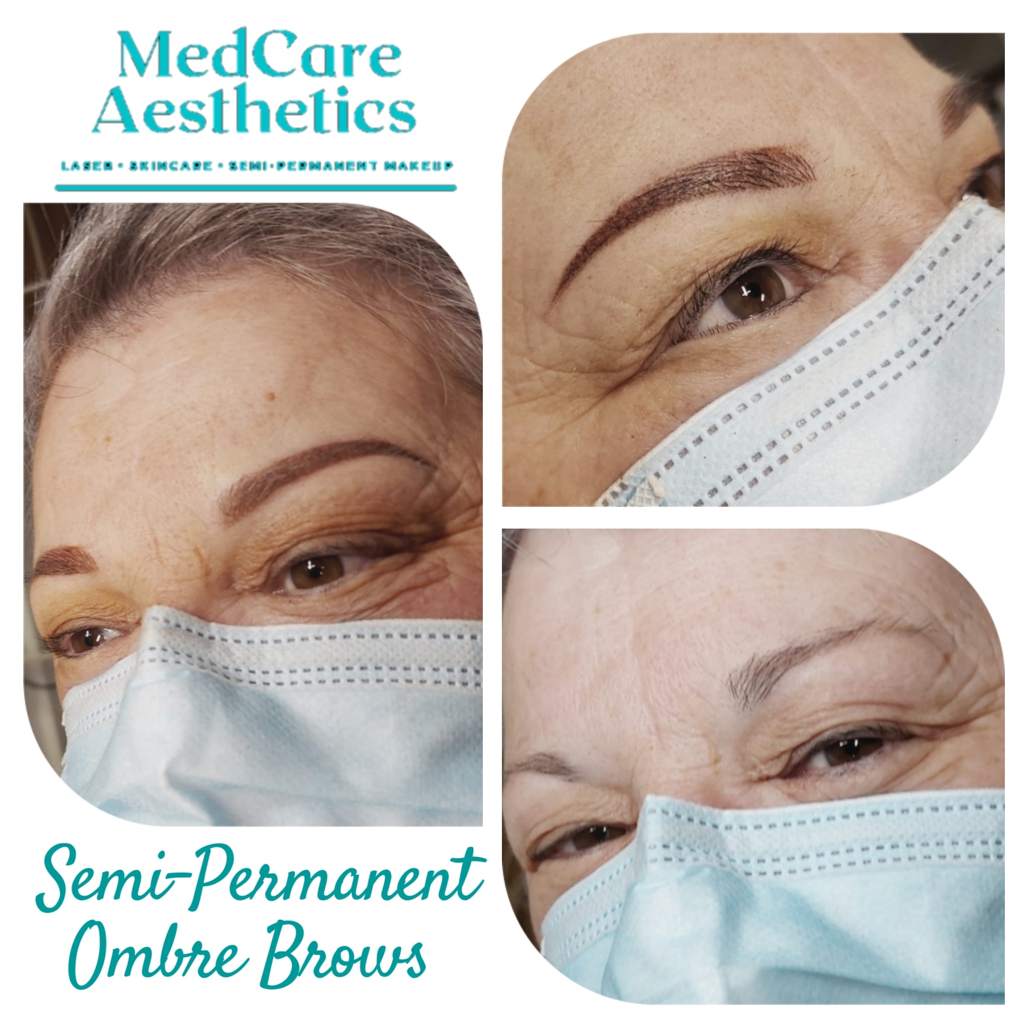 Semi Permanent Makeup - Medcare Aesthetics